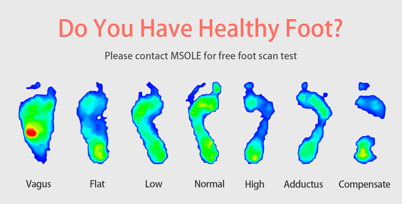 Is Flatfoot Congenital or Acquired?